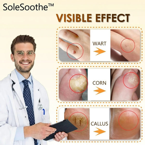 SoleSoothe™ Corn & Callus Cream – Marshmallow Meadows